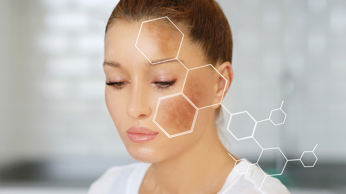 Combat Hyperpigmentation from Within: The Power of Vitamin C – Route2Health